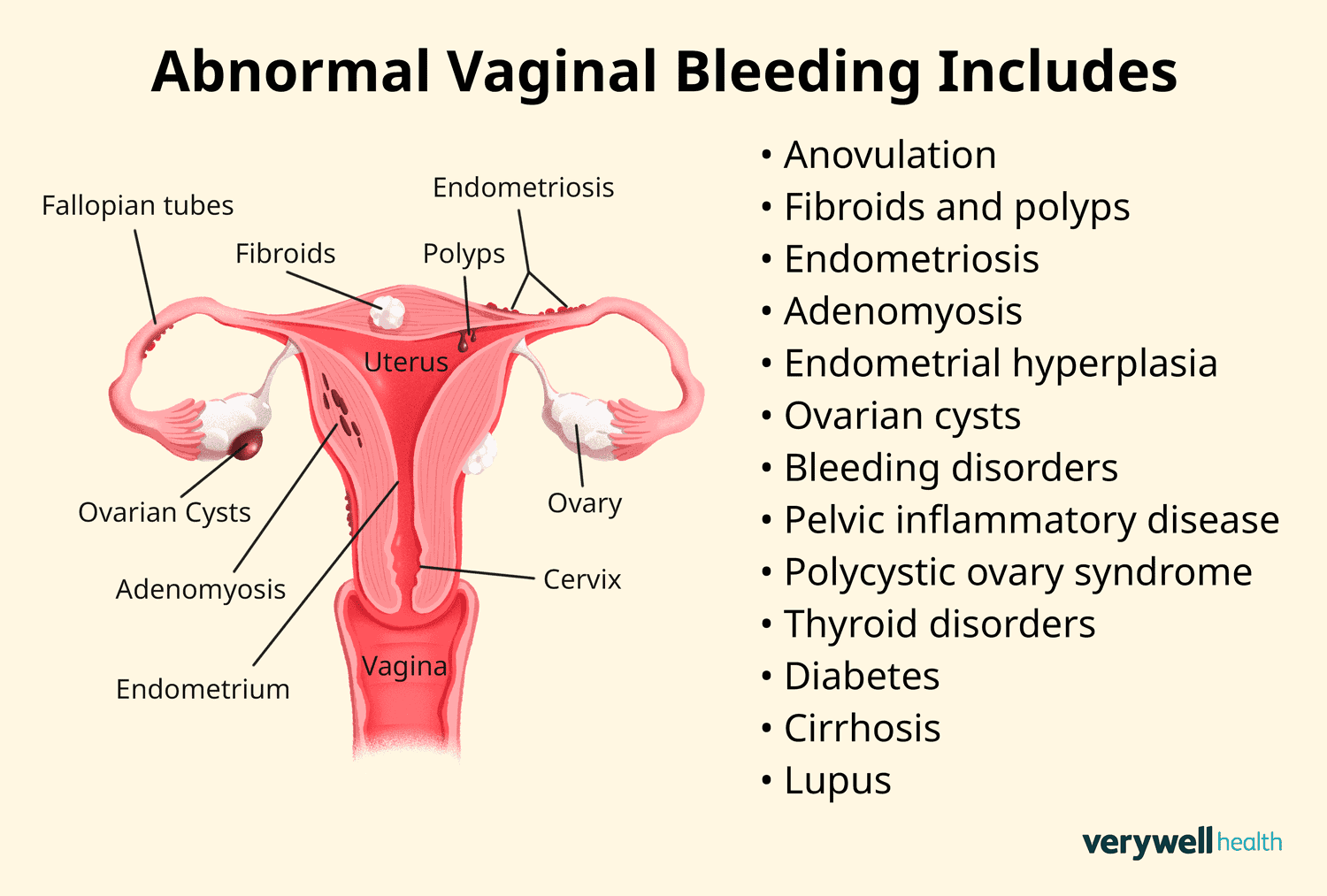 Vaginal Bleeding: Causes, Symptoms, Diagnosis & Treatment - notamedik